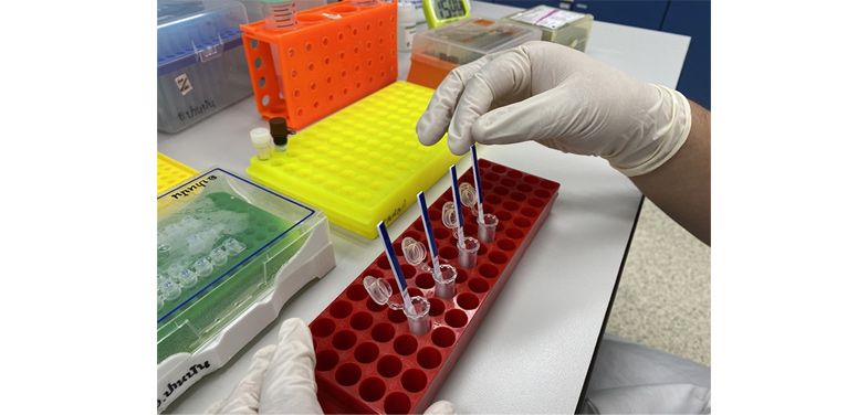 Chula Researchers Develop a Rapid MTB Strip Test for Tuberculosis ...