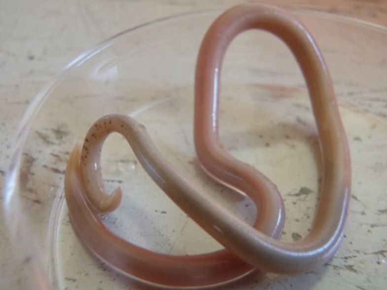 Types of intestinal flat worms - faloviews